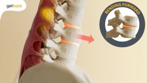 Switch ON the Multifidus to Switch OFF the Pain - back pain relief