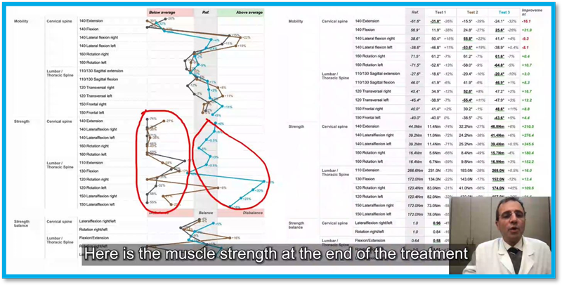 Active physiotherapy for post-operative treatment by spine surgeon